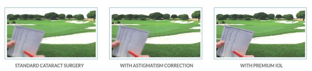 Cataract Care - Valley Eye Professional, LLC